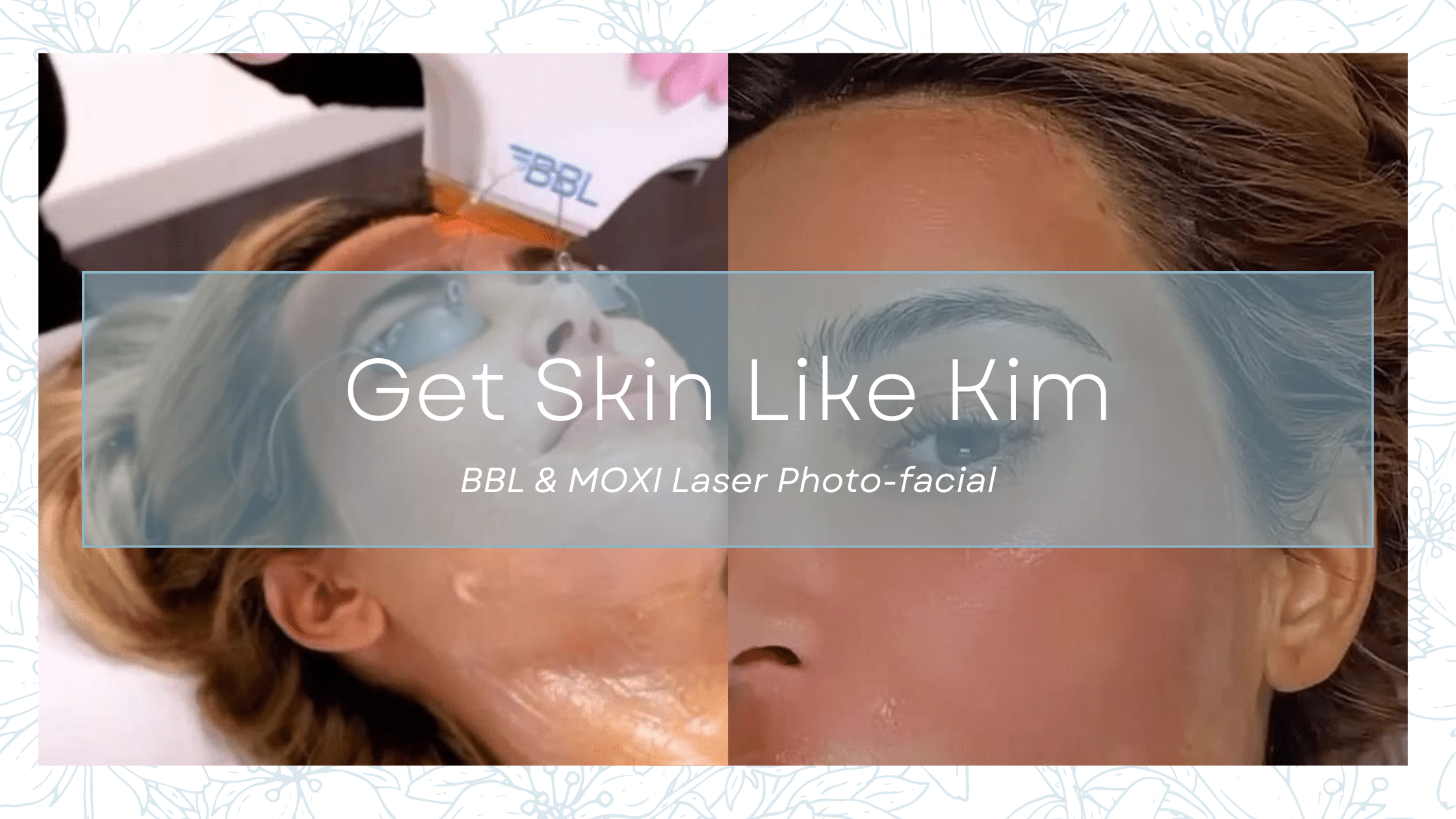 Skin Like Kim - BBL & MOXI - Augusta Aesthetics